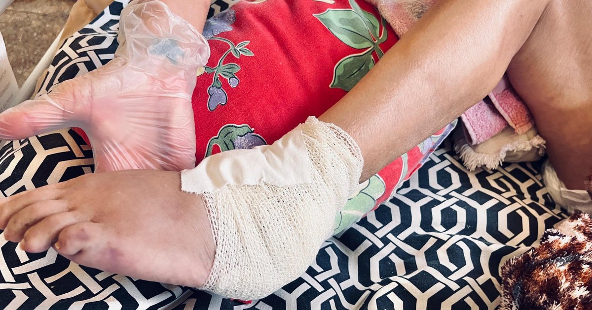 Especialistas do Hospital Dr. Ib Gatto atuam para prevenir úlceras por ...